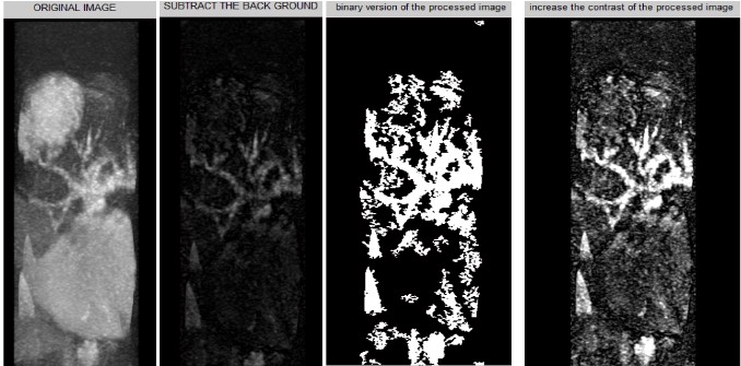 Measuring Soft Organs in Human Body | Institute of Visual Informatics